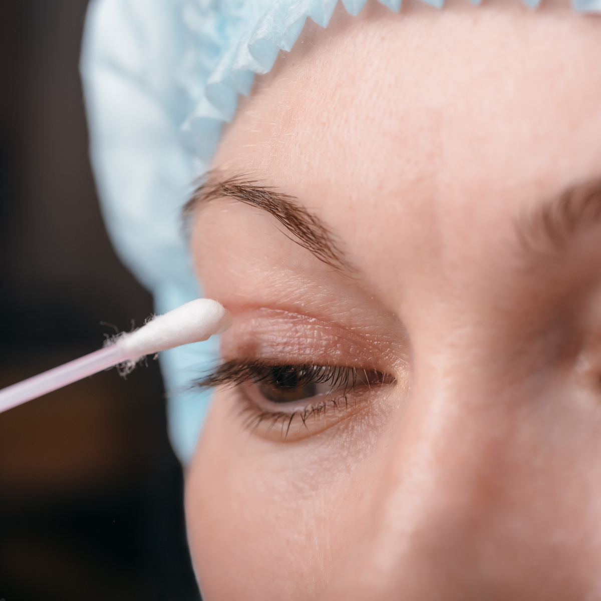 Basis Clinic | Blepharoplasty in Kelowna, BC - Basis Clinic